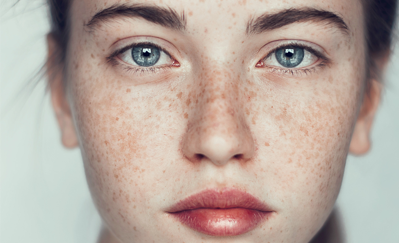 Reductress » Cool! This Model’s Drawn-On Freckles Make Your Real Ones ...